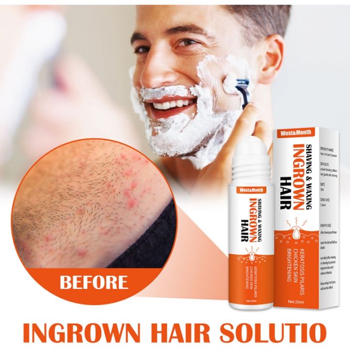 20ml Ingrown Hair After Shave Repair Shaving Waxing Serum Treatment ...