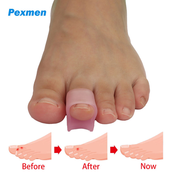 SSD Toe Hammer & Flex Reenergizer Toe Gel Splint Toe Correction Device ...