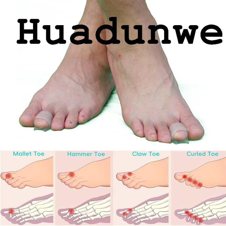 Huadunwen 2025 Pexmen 2/4Pcs Hammer Toe Corrector Hammertoe ...
