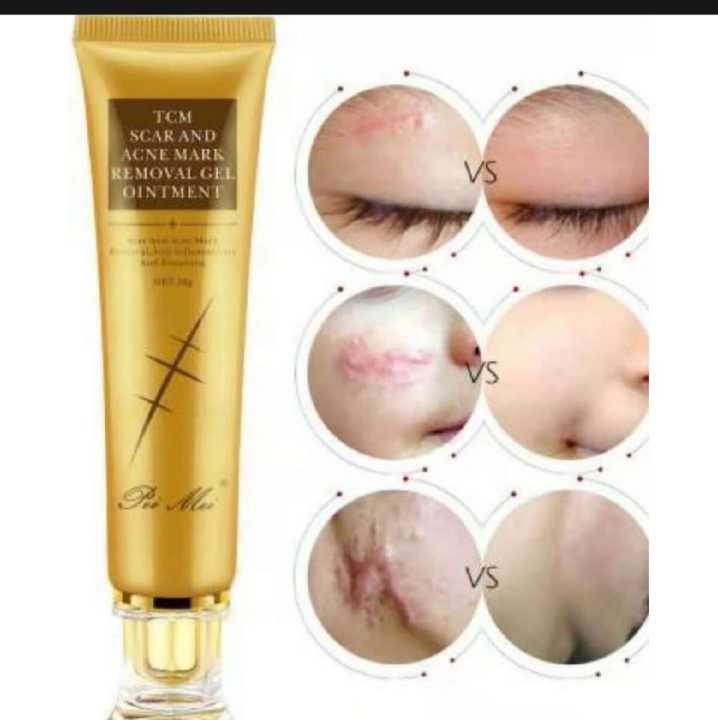 Pei Mei TCM SCAR AND ACNE MARK REMOVAL GEL OINTMENT | Daraz.com.np