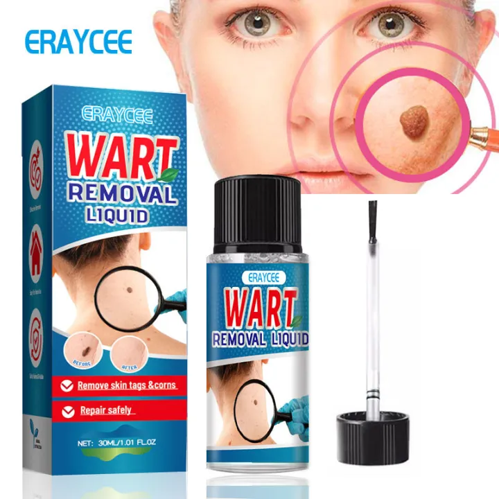 ERAYCEE Cross-border Independent Station Amazon Ke Wart Liquid Ke Wart ...