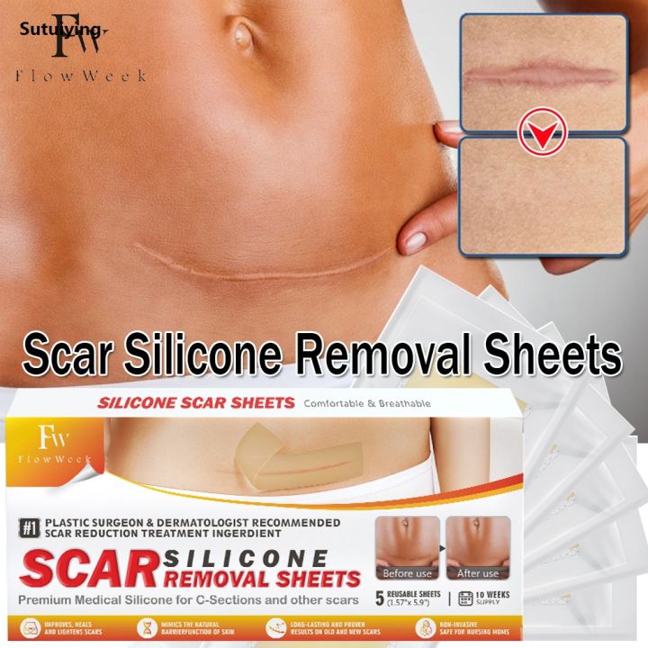 Sutuiying FlowWeek Silicone Scar Patch, Scar Removal, Hypertrophic Scars, Fashion Keloid Burn ...