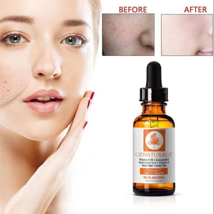 Vitamin ECSerum Oznaturals Facial Serum 30ml OZ Naturals Daraz .np