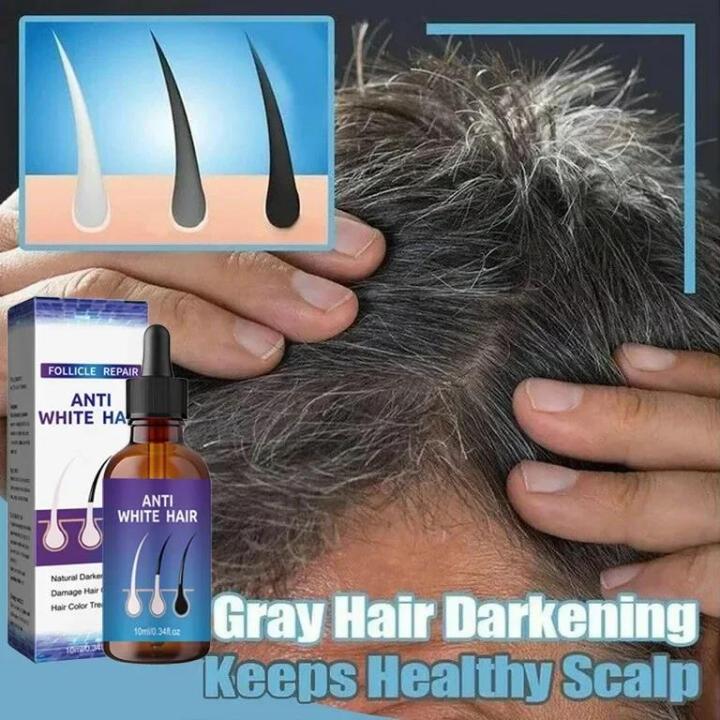 Grey Hair Treatment White to Black Grey Hair Serum restores natural ...