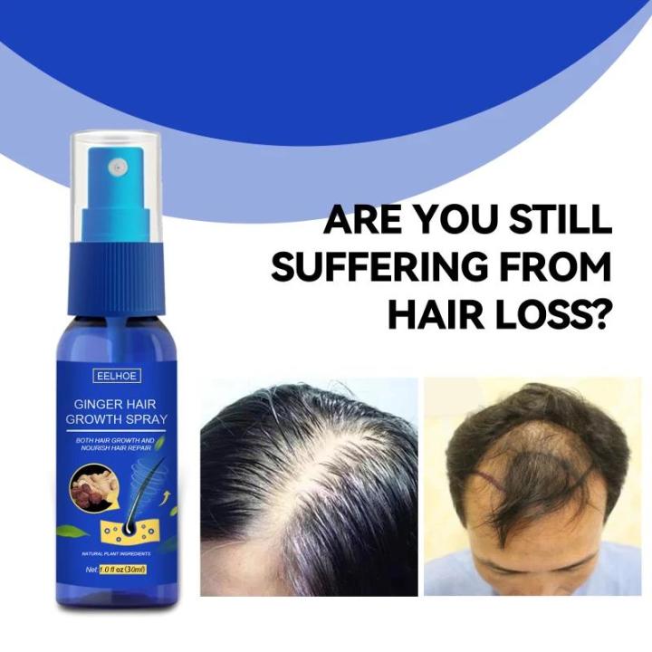 Nourishing Sprout Spray Hair Care 30ml10Profesional/Spray Ginger Ale ...