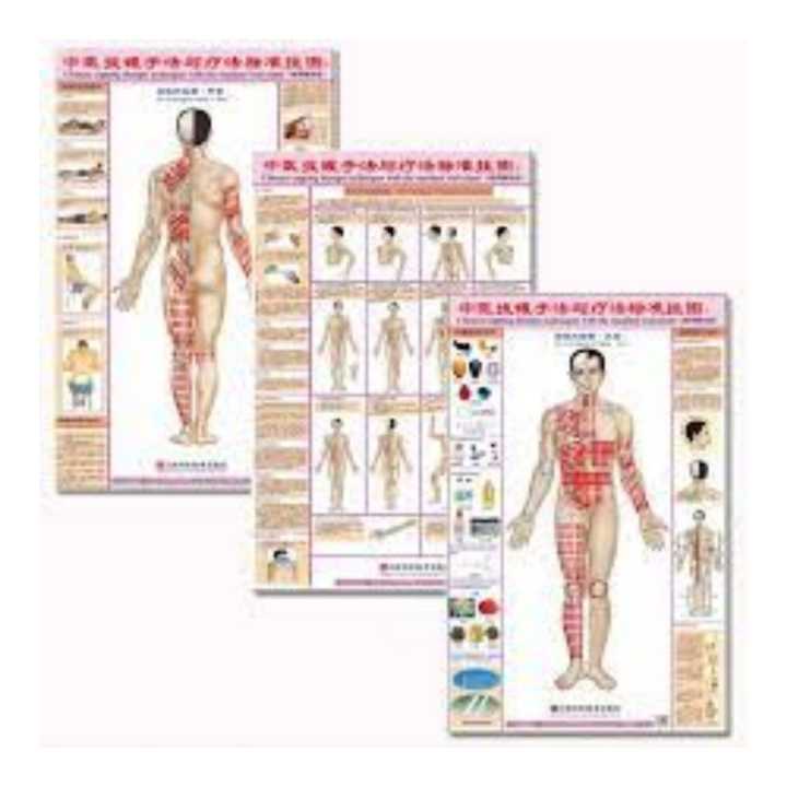 ACS Cupping Therapy Chart - Hijama / Vacuum | Daraz.com.np