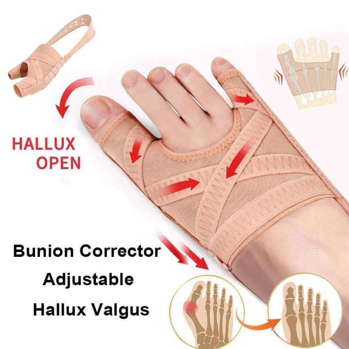 Adjustable Hallux Valgus Bunion Corrector Orthotics Big Toe Separator ...