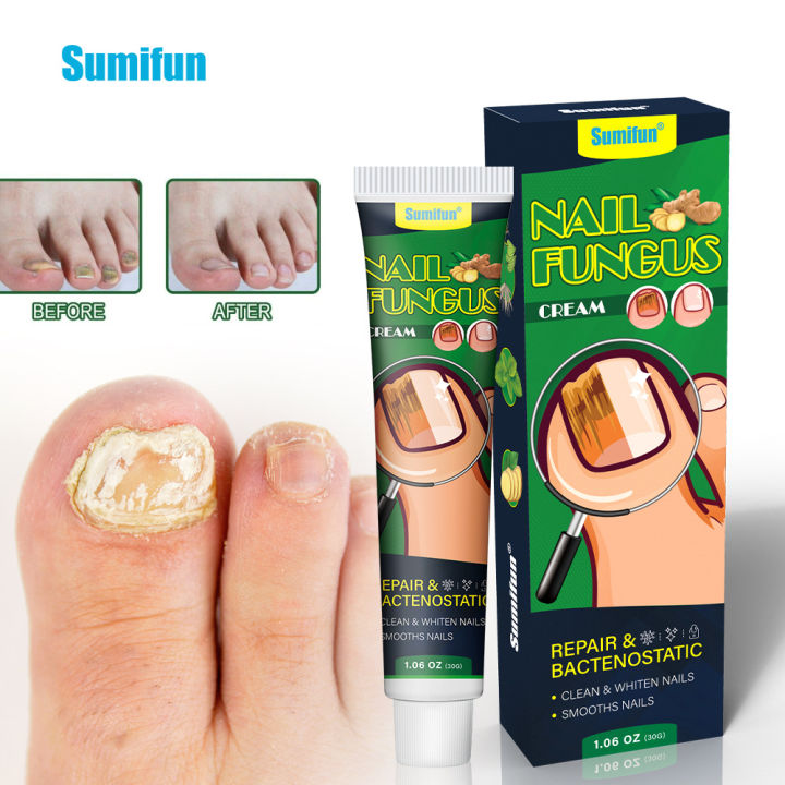 Sumifun Nail Fungus Care Balm Bright Nail Cream Amazon AliExpress TEMU ...