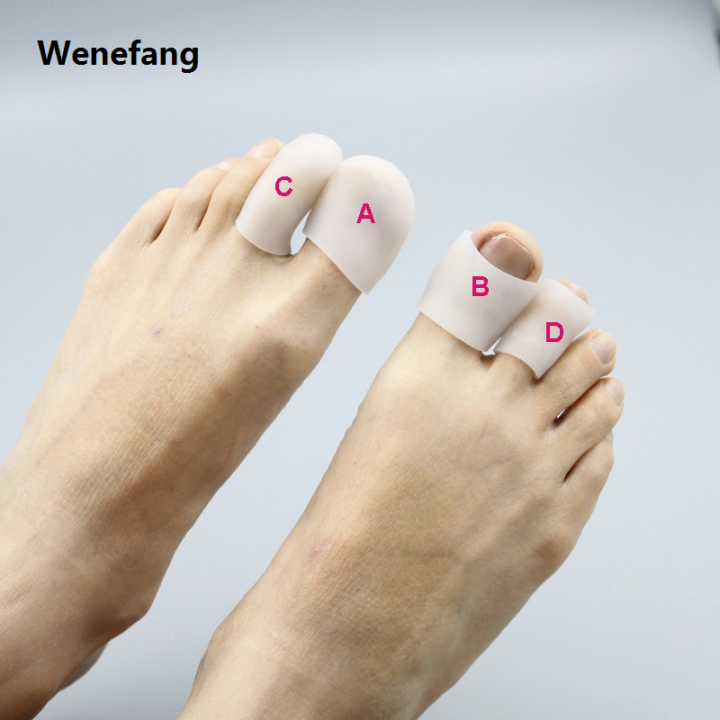 Wenefang 4Pcs Foot Corns Blisters Remover Gel Gel Tube Bandage Finger ...