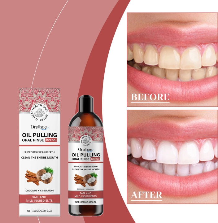 Teeth and mouth, effective to remove bad breath fresh mouthwash smell ...
