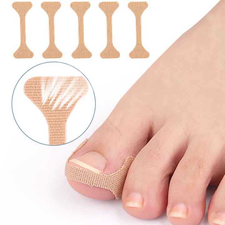 5/15/30 Pcs Ingrown Paronychia Toenail Corrector Strips Anti Fungal ...