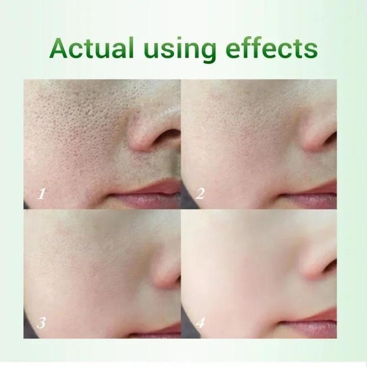 BataBata Pore Shrink Face Serum Green Tea Oil Control Remove Dark Spots ...