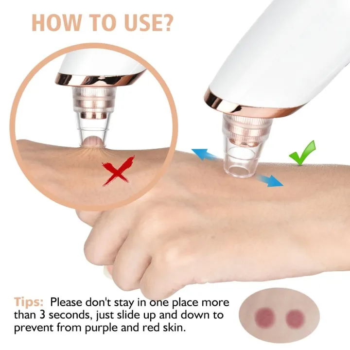 5 in 1 Electric Blackhead Acne Oil Remover Vacuum Suction Face Pore ...