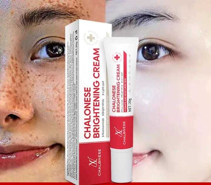 Chalonese Skin Brightening Cream 20g | Face Cream for Dark Patches ...