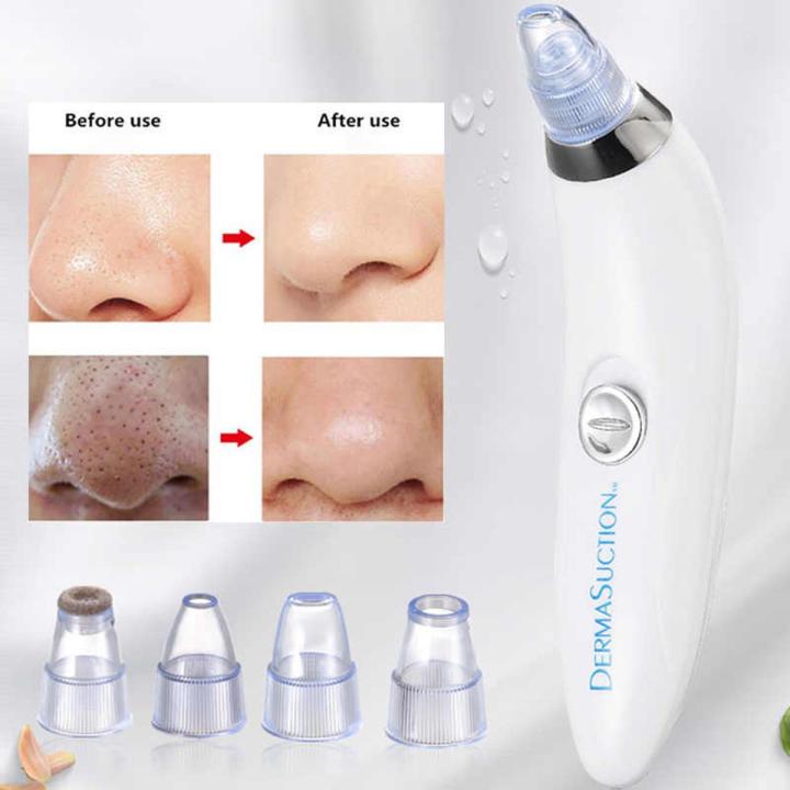 Derma Suction Blackhead Acne Oil Remover Vacuum Suction Face Pore ...