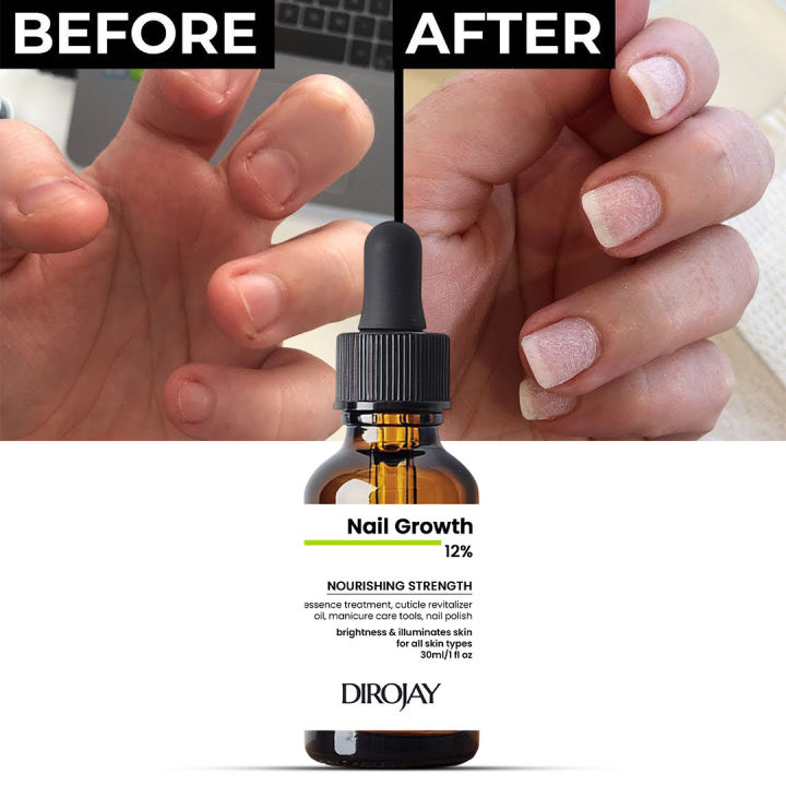 Serum for fast nail growth - Nail growth serum oil serum for long and ...