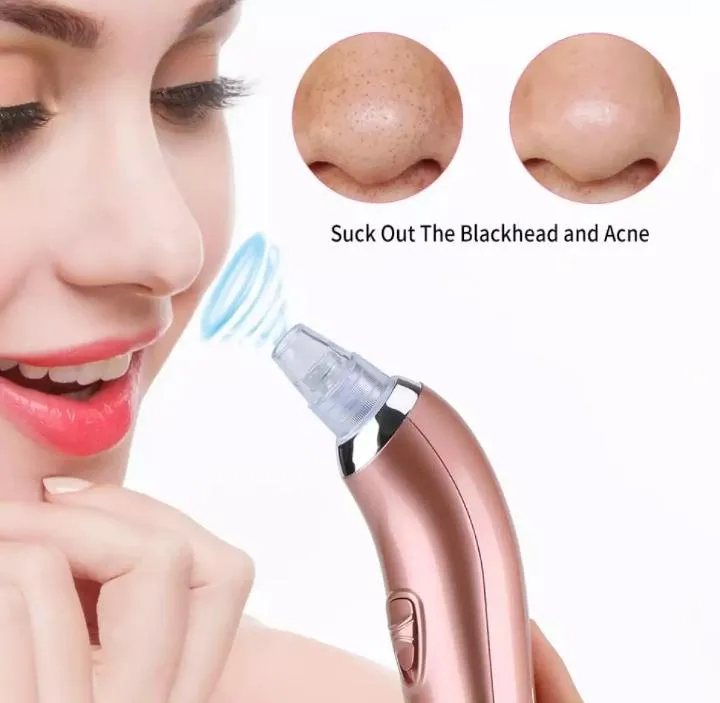 Chargeable Blackhead Removal Machine - 4 in 1 Black Head Remover ...