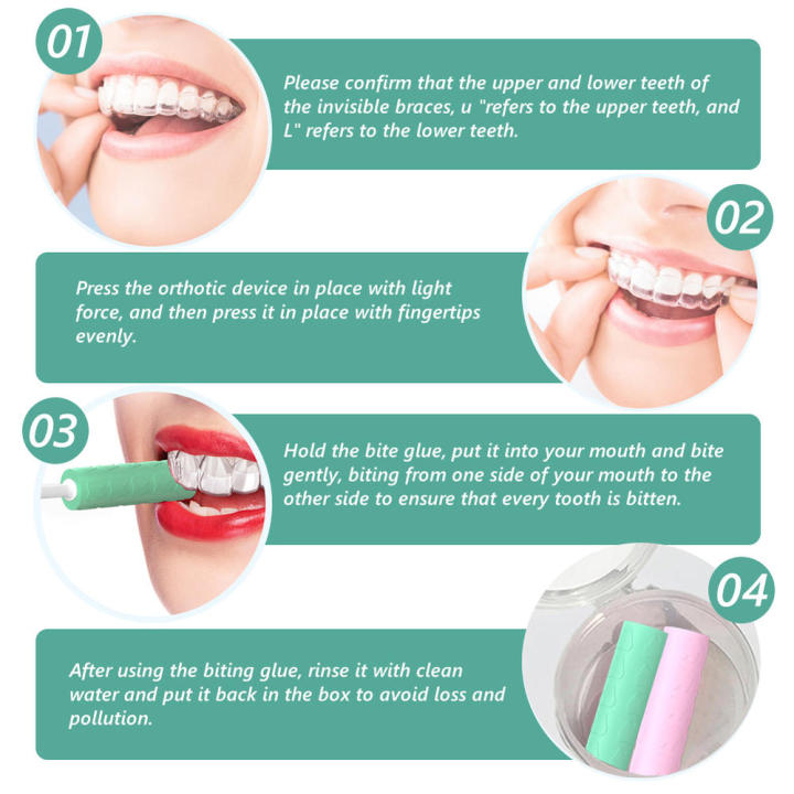 Adhesive Invisible braces Flexible Orthodontic teeth chewing glue ...