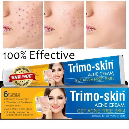 Trimoskin New Acne Cream For All Skin Types | Medicated Cream | Remove ...
