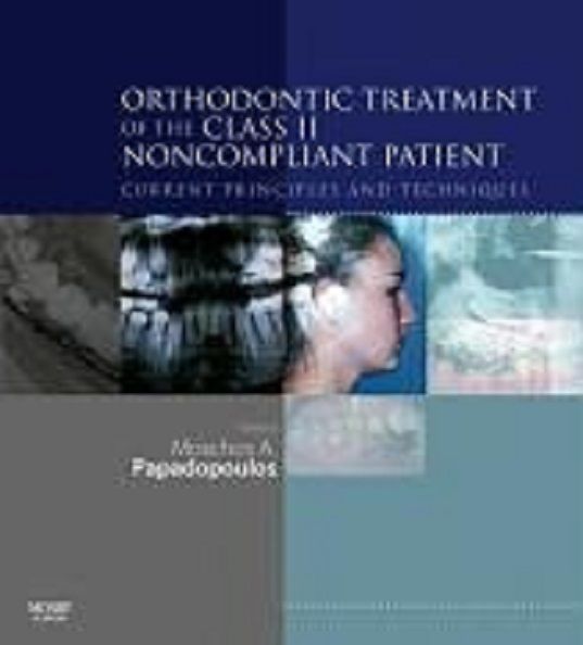 Orthodontic Treatment of the Class II Noncompliant Patient Current ...