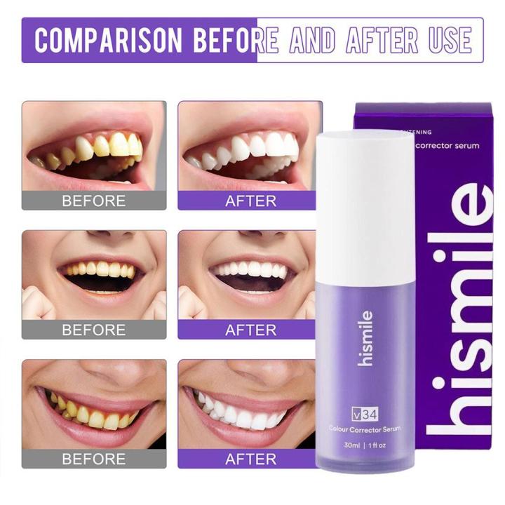 Hismile v34 Color Corrector Purple Teeth Whitening Toothpaste Kit ...