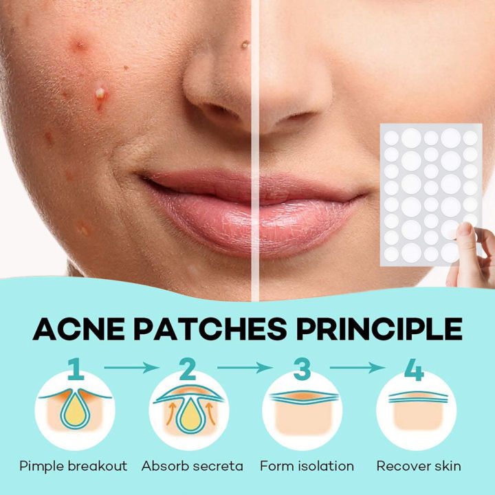 Pimple Patch Fast-Acting Invisible Makeup Clarifying Closed Circles ...