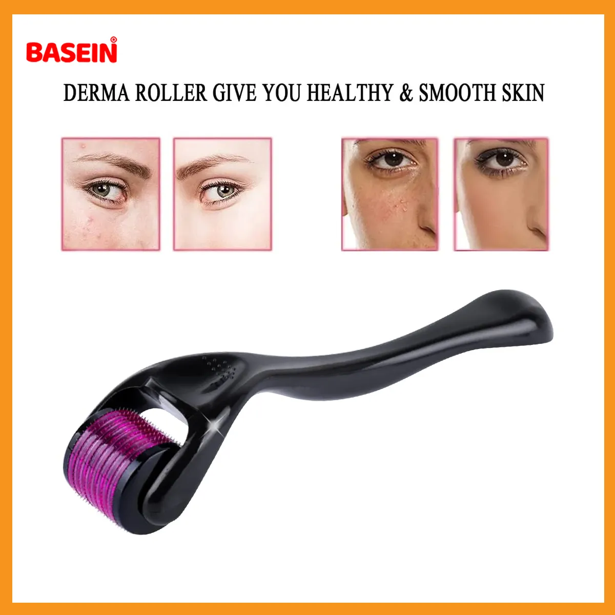 Derma Roller, DermaRoller Microneedling Roller with 540 Needles ...