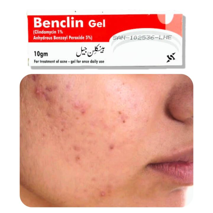 Sante Pharma Benclin Gel, 10g | Daraz.pk