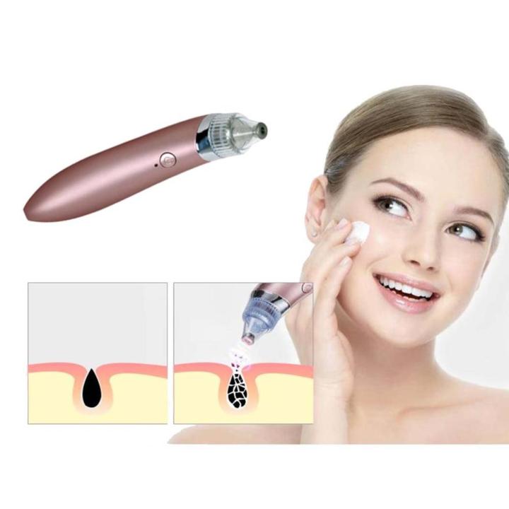 Face Pore Cleaner Blackhead Remover Vacuum Facial Cleaning Beauty ...