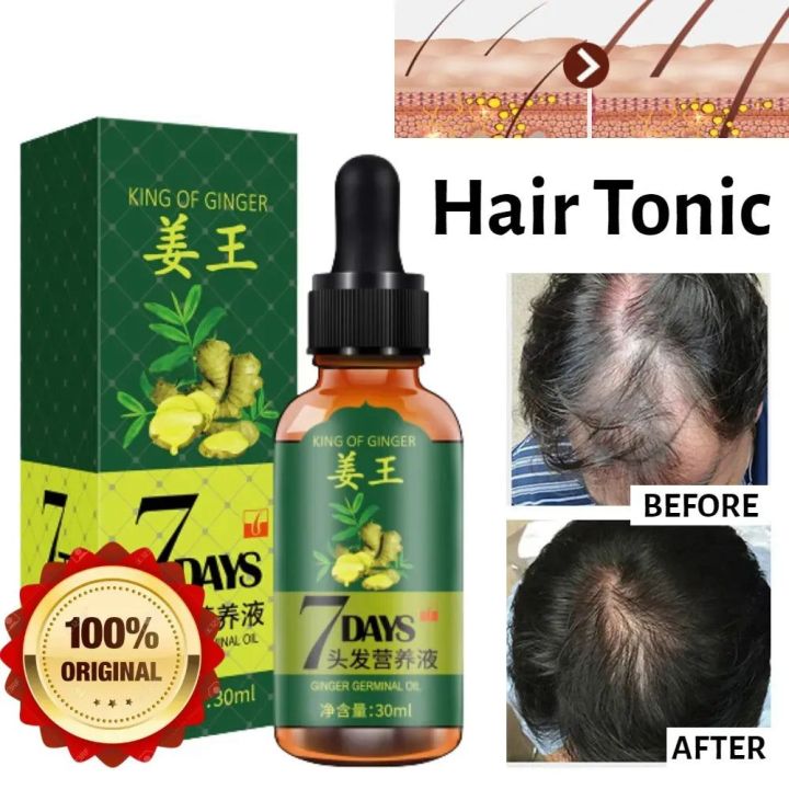 7 Days Ginger Hair Growth Oil Serum 30ml – Fast Hair Regrowth, Anti ...
