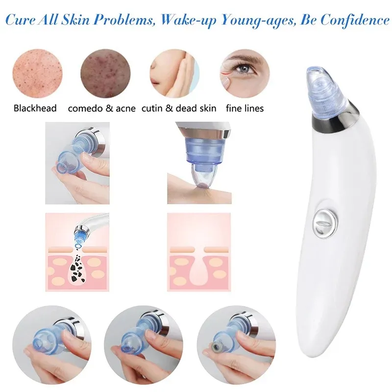 Derma Suction Blackhead Removal Machine Derma Suction 4 in 1 Black Head Remover Machine Acne Pore Cleaner Vacuum Suction Tool Blackhead Removal On Nose Sucking Machine Cell Pperated Cell Not Included ...