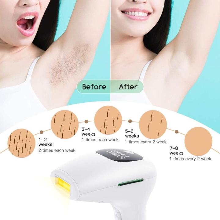 AS 500,000 IPL Hair Removal for Women and Men Permanent Hair Removal ...