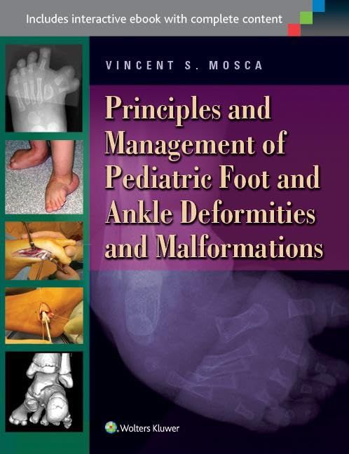 Principles and Management of Pediatric Foot and Ankle Deformities and ...