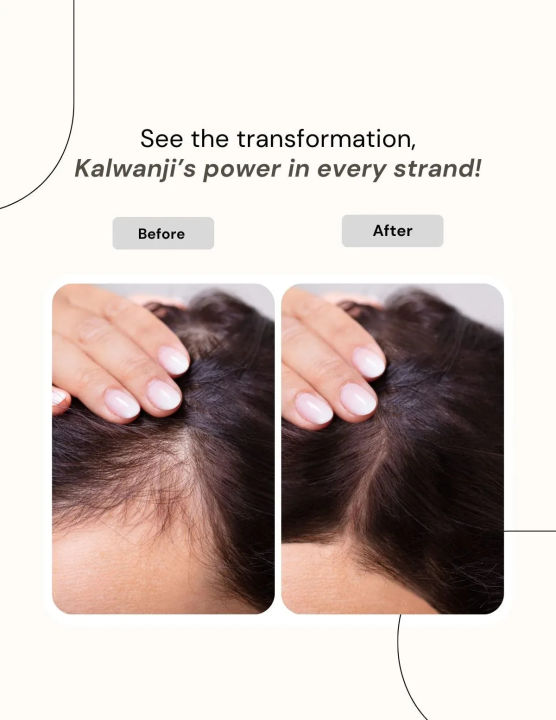 Kalwanji Shampoo Orgaanic Kalonji Hair Shampoo CH6 – Powerful Hair Fall ...