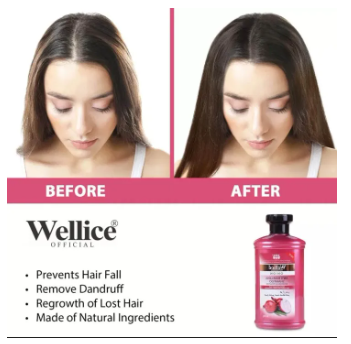 Wellice Onion Anti Hair Loss Shampoo 400ml | Daraz.pk