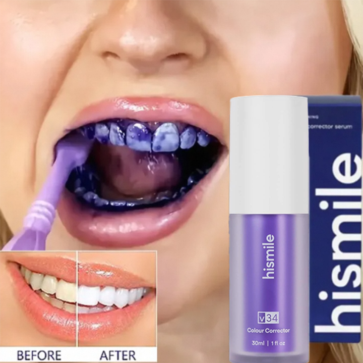 Hismile V34 Color Corrector Purple Teeth Whitening Toothpaste | Instant ...