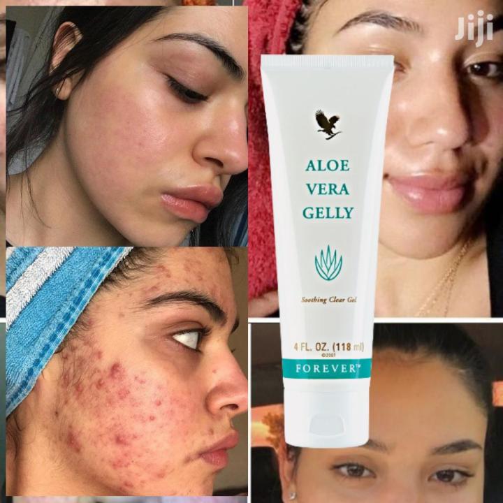 Forever aloe vera jelly tube for skin 118 ML | Daraz.pk