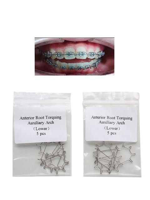 5pcs Dental Anterior Root Torquing Auxiliary Arch Small Middle Big ...