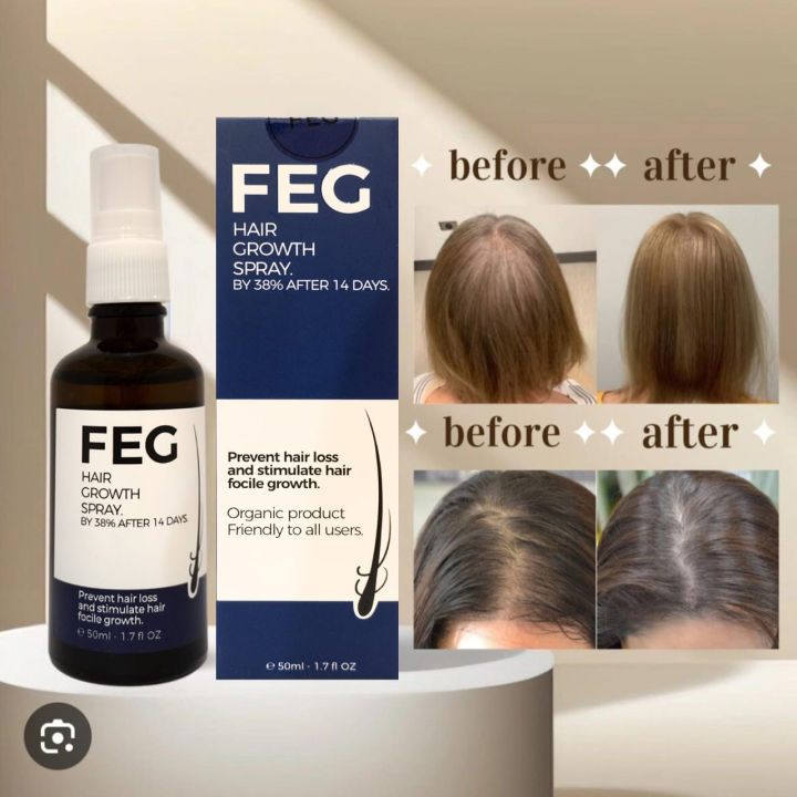FEG Plus Hair Growth Spray – 50ml | Hair Fall Solution for Men & Women ...