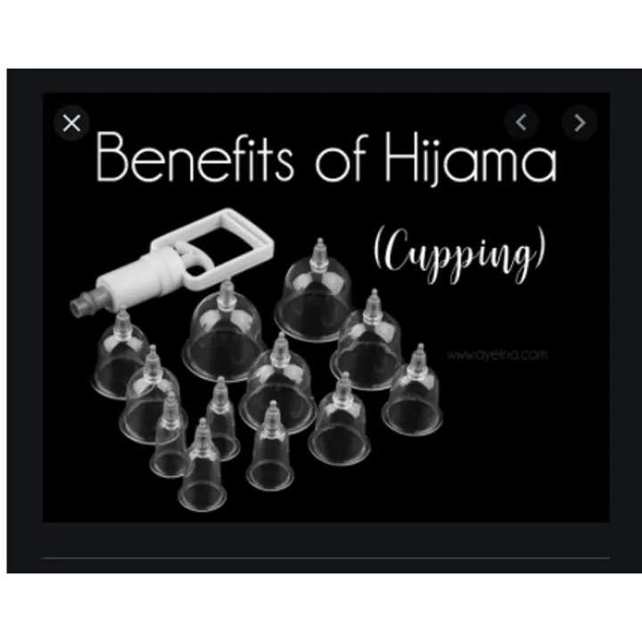 hijama cups 12 cups with pump | Daraz.pk