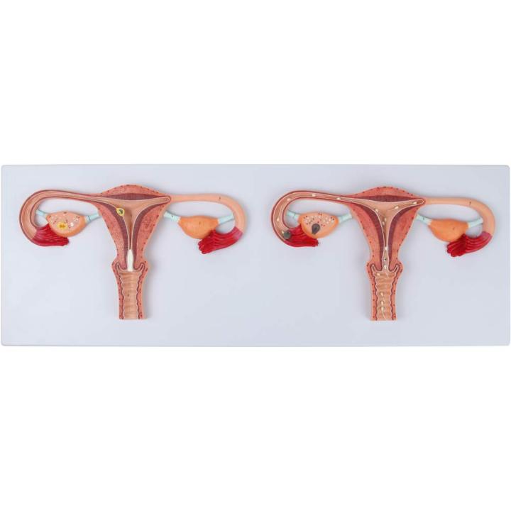 Human Fertilization Process Model, Features Cross-Section of Uterus ...