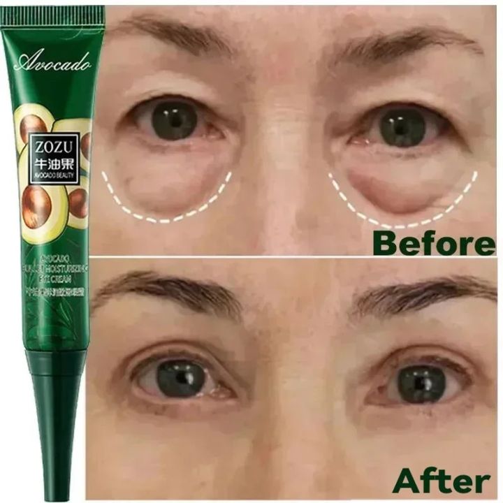 Nnoregretsss 7 Day Tighten Wrinkles Eye Cream Eye Fine Line Whiten ...