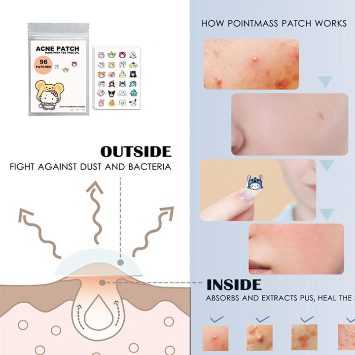 96pc Cat Repair Acne Patch Facial Skin Care Fade Blemishes Pimple Marks ...