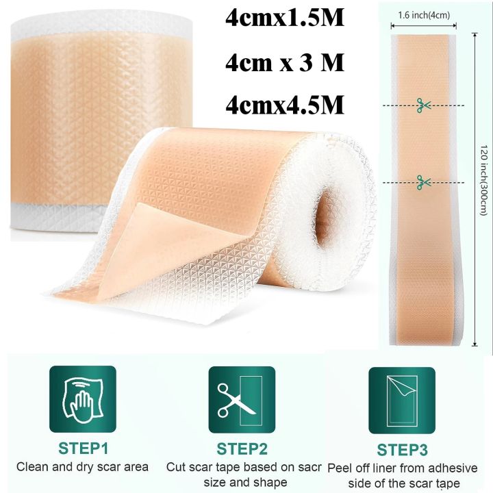 CollapseTen 1.5-4.5M Silicone Scar Tape for Surgical Scars Medical ...