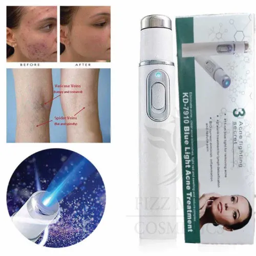 Blue Light Laser Therapy Pen | Anti-Acne Scar & Spot Removal Tool KD ...