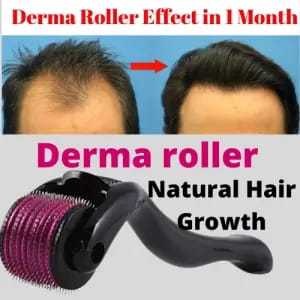 MGZ 0.5Mm Derma Roller with 540 Micro Needle for Hair Growth and Facial ...