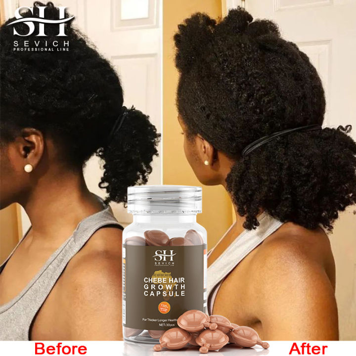 Chebe Fast Hair Growth Capsule Chad 100% Natural Hair Growth Oil Anti ...