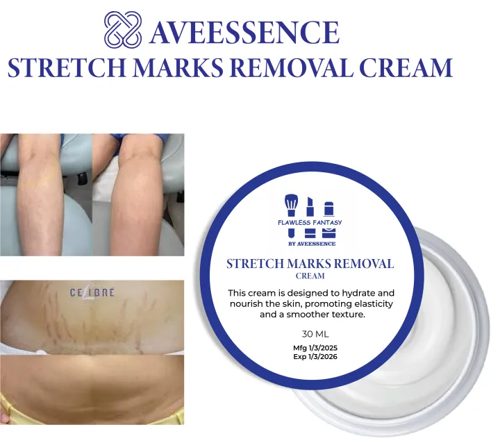 Aveessence Stretch mark removal cream After pregnancy for stretch marks ...