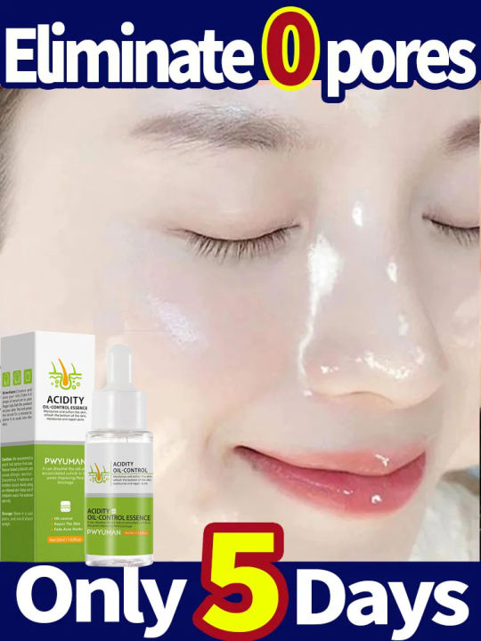 Acidity Pore Shrink Face Serum Remove Blackheads Acne Oil Control ...
