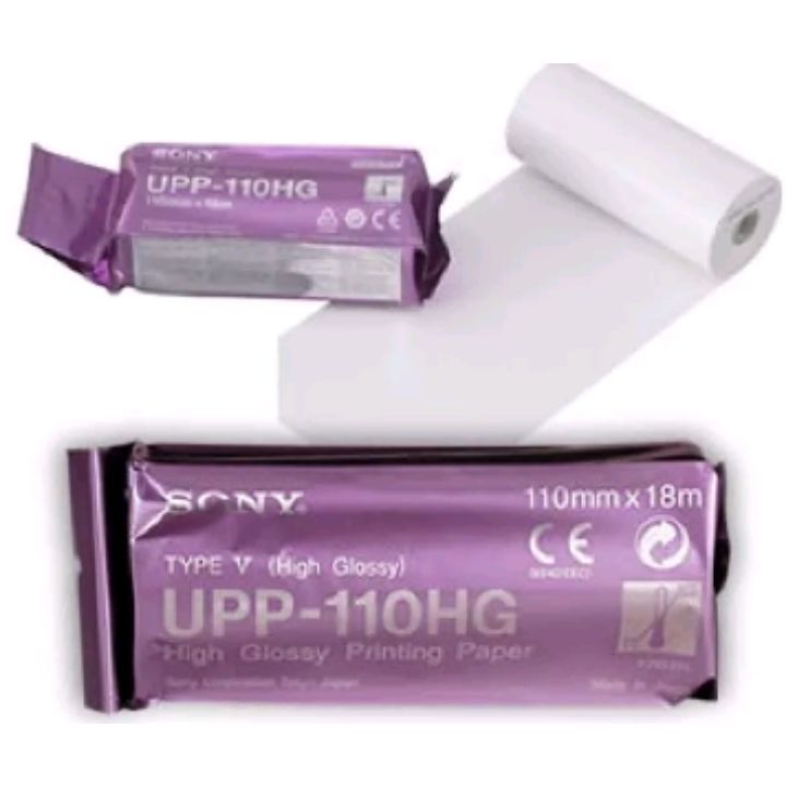 Ultrasound Printing Paper Roll - High Glossy Ultrasound Paper Price ...